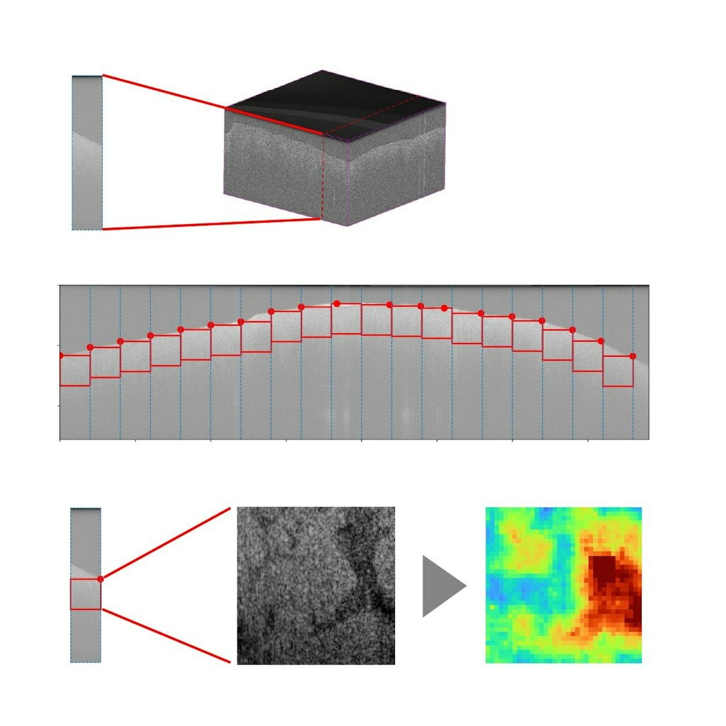 Kürzere OP-Zeiten bei Leberkrebs dank neuer Analyse-Methode